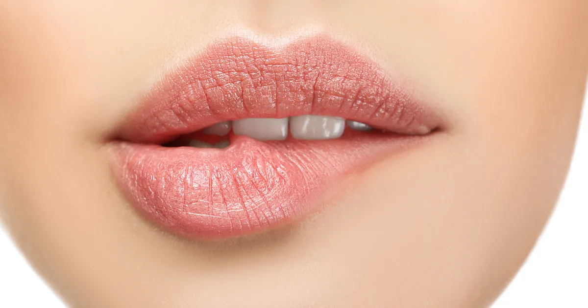 Just see koostisosa aitab kuivad huuled prunti ajada