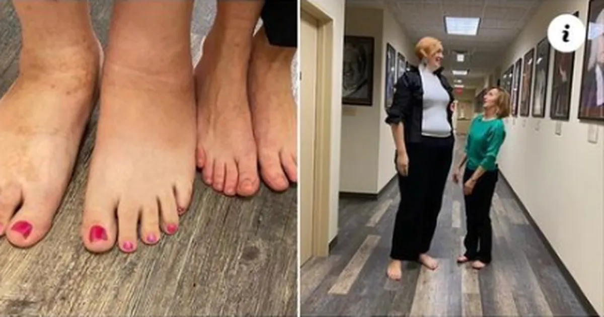 Maailma suurimate jalgadega naisel on kiimas meestest kõrini