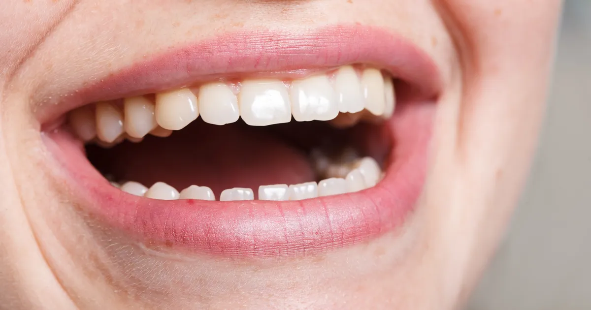 Laialt kasutatav vahend soodustab vähiga seotud bakterite vohamist