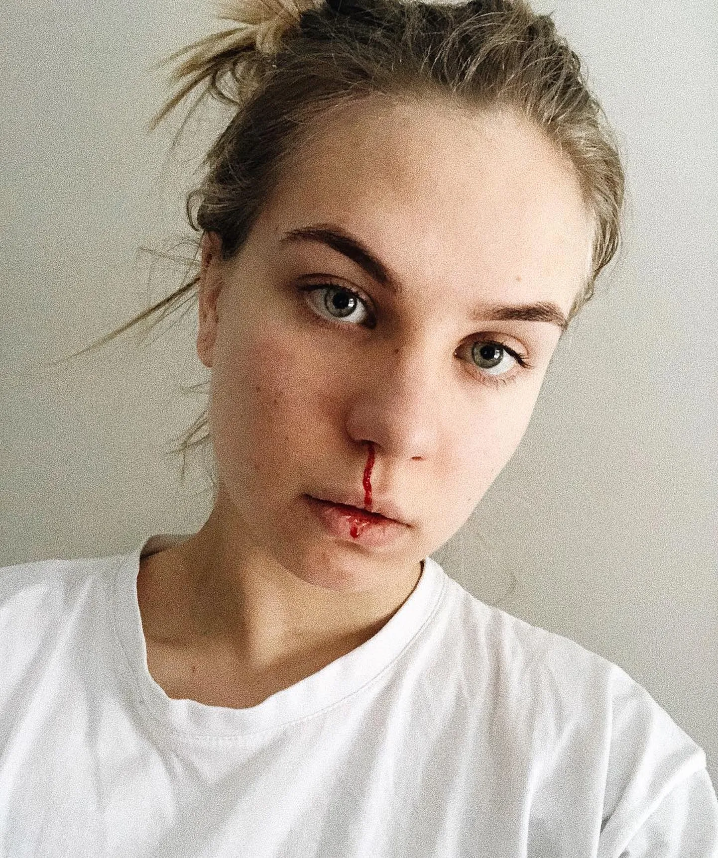 Kohalik juutuuber jagab šokeerivat pilti: reaalses elus saavad kõik haiget!